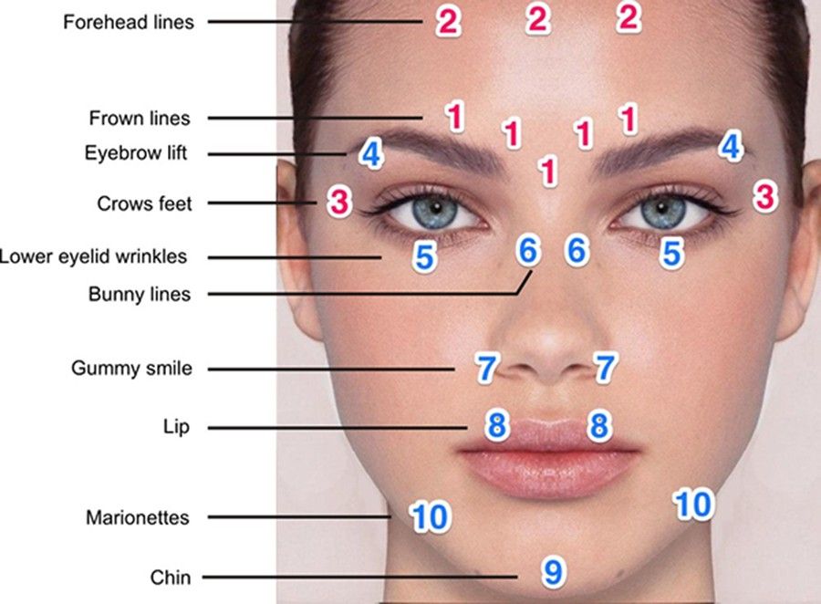 Anti Wrinkle Injections Such As Botox
